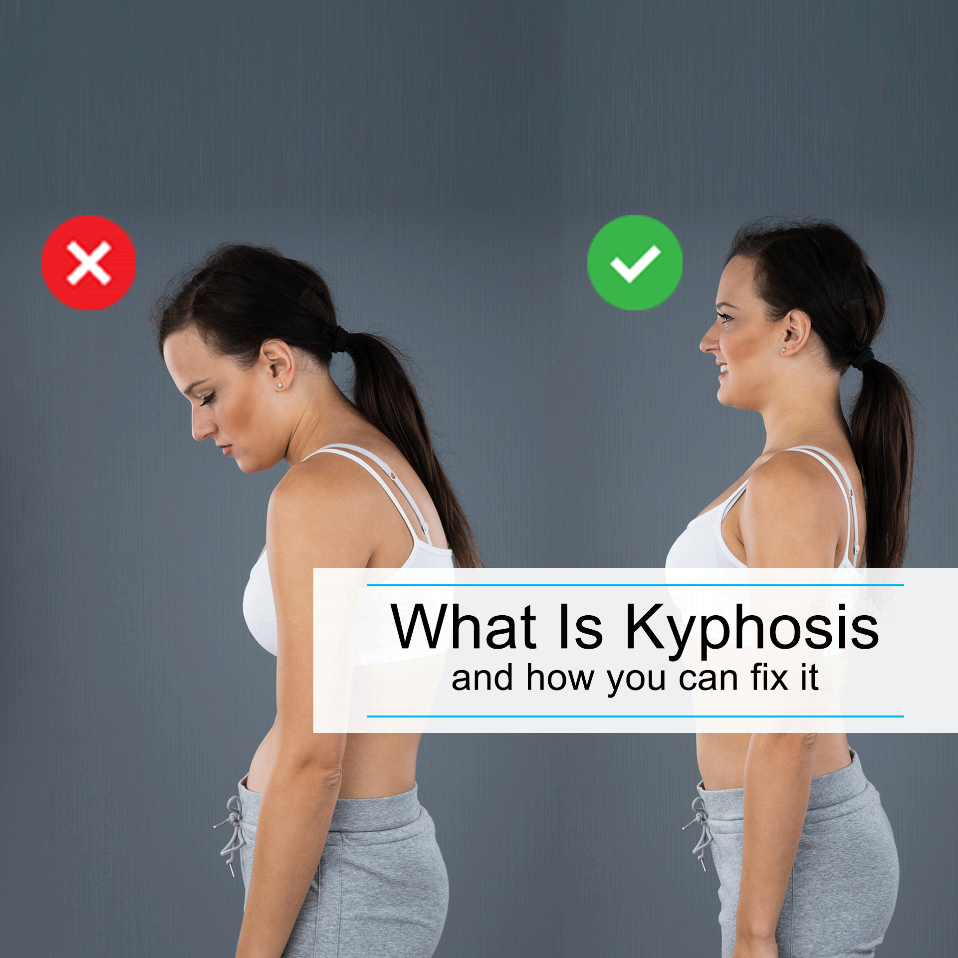 Kyphosis: Causes, Symptoms, and Solutions for Postural Health – Posture Guy Mike