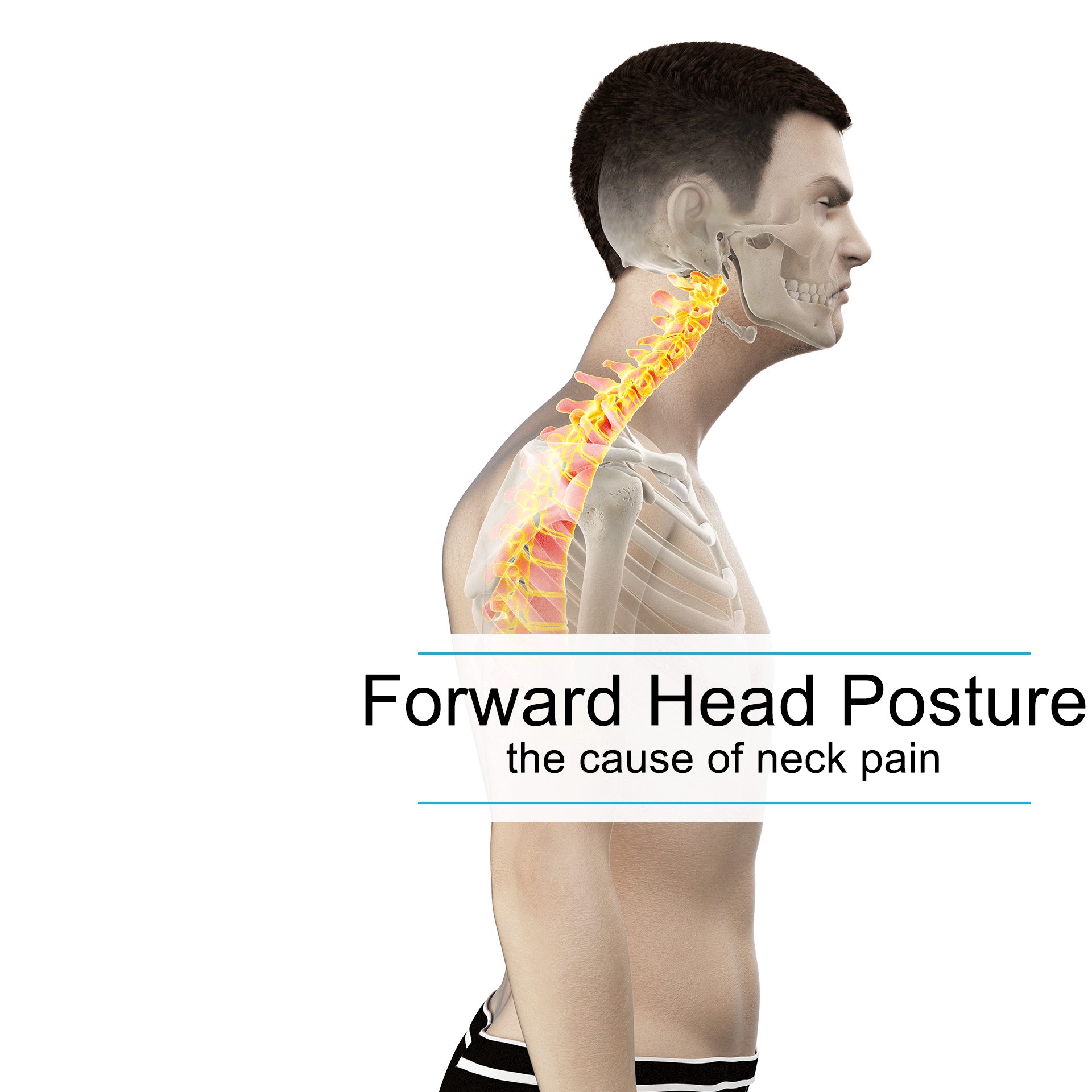 Forward Head Posture: The Cause of Neck Pain – Posture Guy Mike